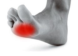 Leneva® Injections for Ball of Foot Pain | Non-Surgical Relief For ...