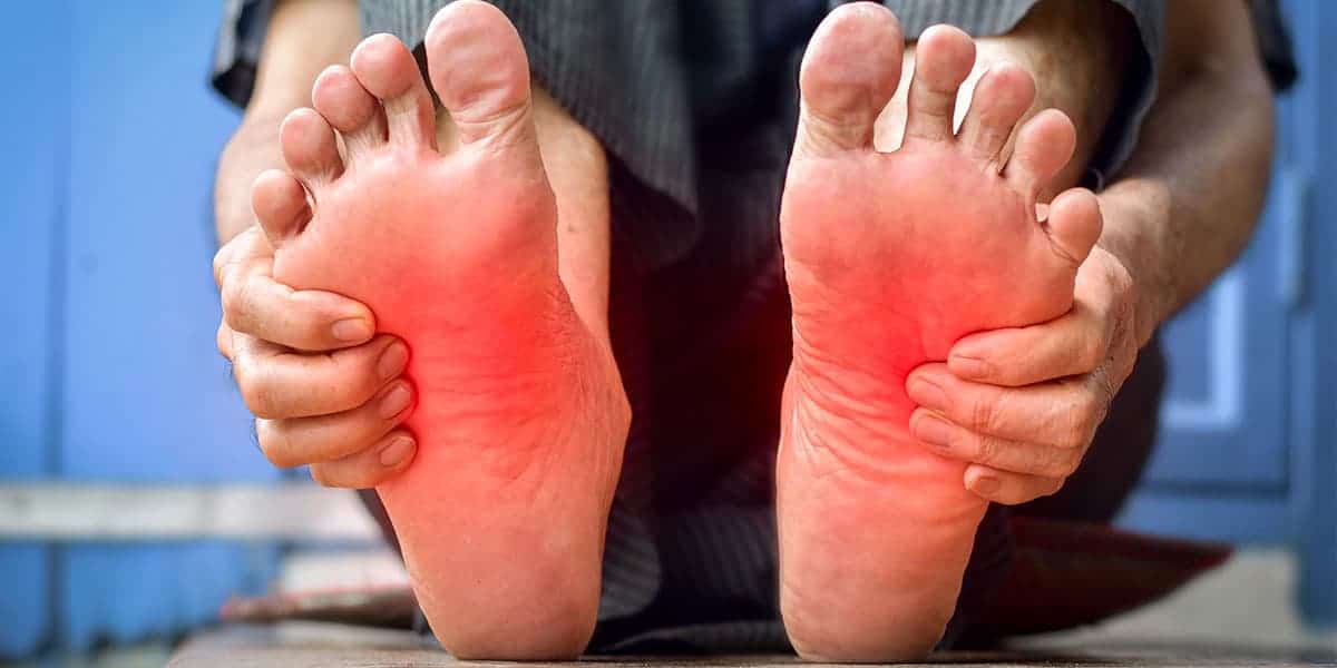 Erythromelalgia: Symptoms, Causes, and Treatments | Dr. Bob